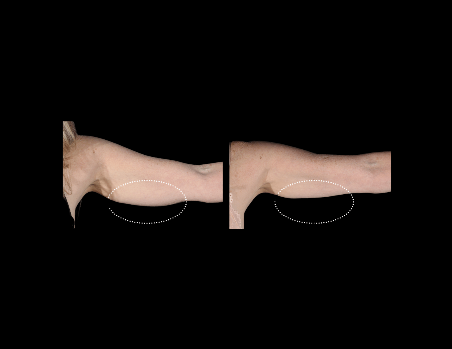 Before & After - Skinic